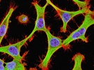 New Possibilities in Research with the Latest High Content Screening ...