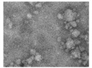 Isolating Serum Exosomes Using ExoQuick | Biocompare.com Kit/Reagent Review
