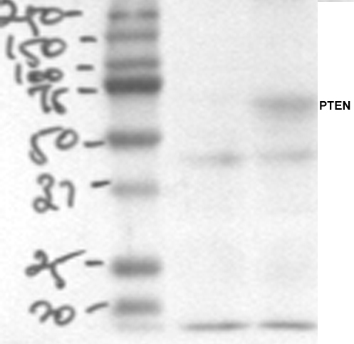 Western blot antibody for PTEN from R&D systems | Biocompare Antibody ...