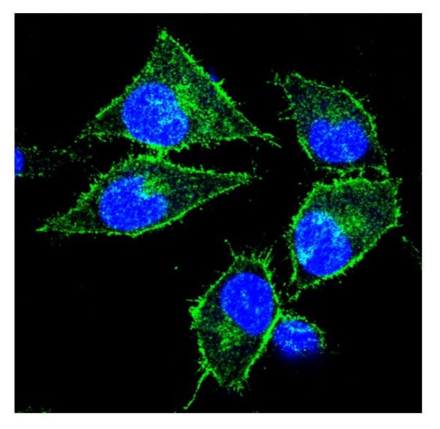 Immunocytochemistry of EGFR | Biocompare Antibody Review