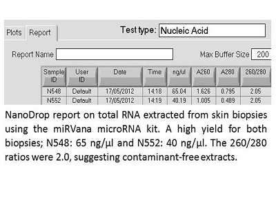 Total RNA Extraction from Skin Biopsies | Biocompare.com Kit/Reagent Review