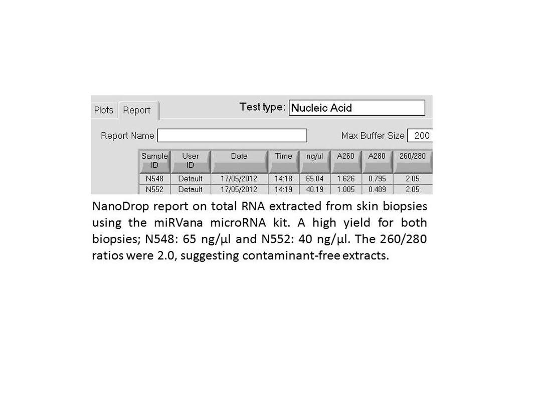 Total RNA Extraction from Skin Biopsies | Biocompare.com Kit/Reagent Review