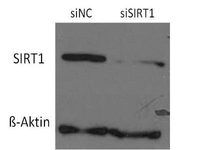 SIRT1 Western Blot Using Primary CD4+ T-Cells | Biocompare Antibody Review