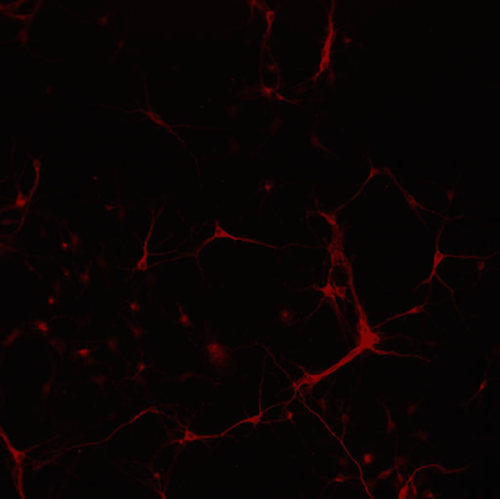 Dendrite Marker In Primary Mouse Neurons | Biocompare Antibody Review