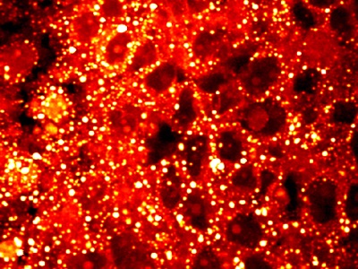 Pros and Cons of Three High-Resolution Mass Spec Approaches ...