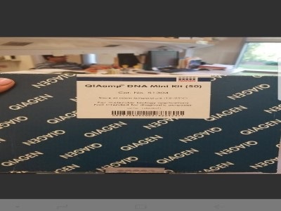 Qiaamp Dna Mini Kit Biocomparecom Kitreagent Review