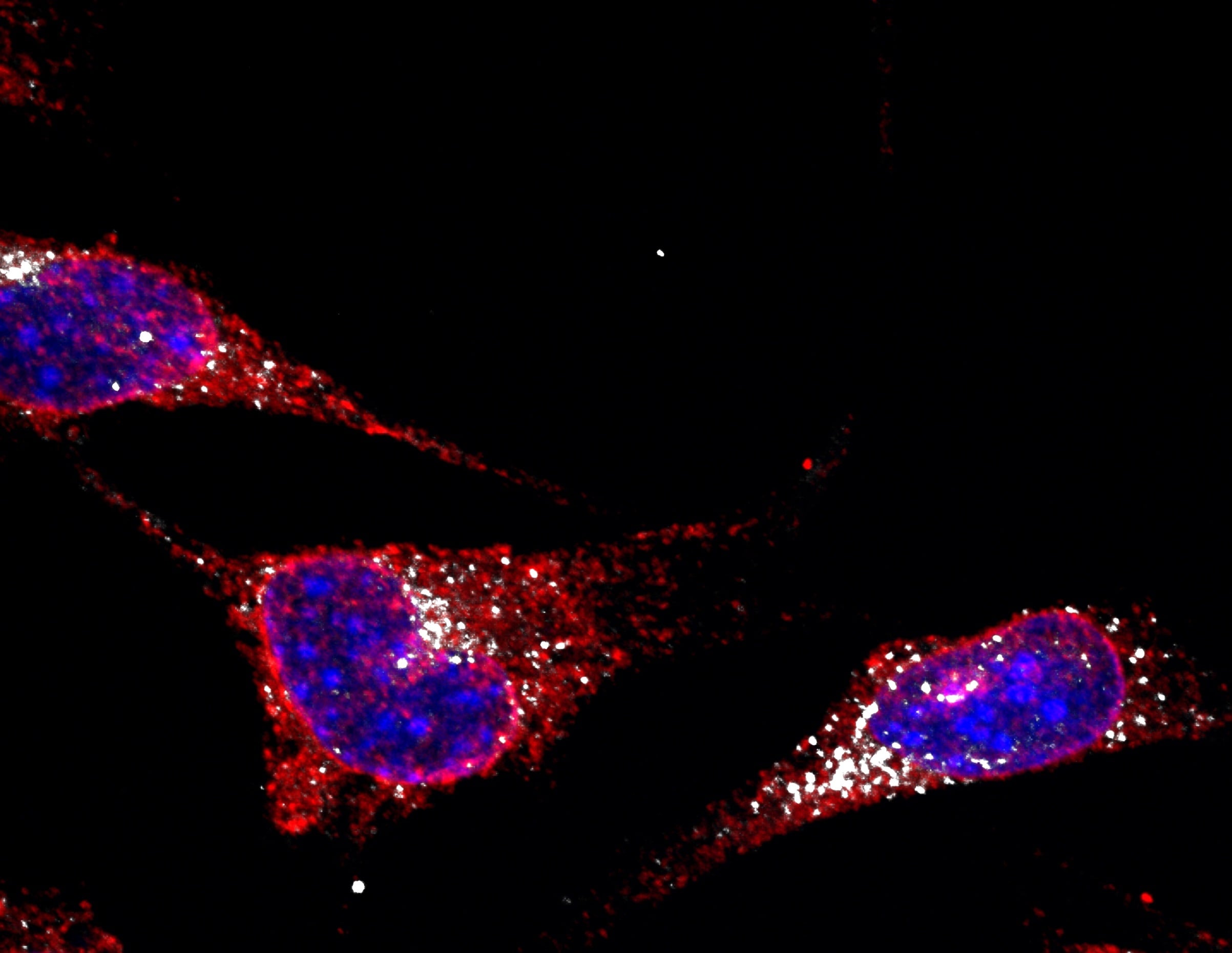 Genetic Disease Gives Clues on Drug Resistance | Biocompare: The Buyer ...
