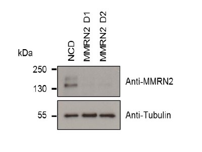 MMRN2 Antibody for Western Blot of HUVEC Lysates | Biocompare Antibody ...