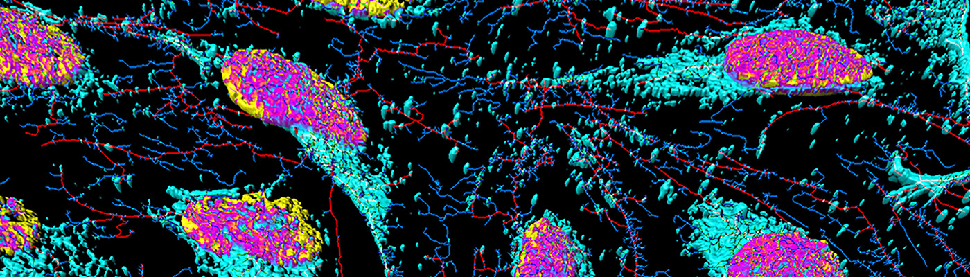 Combating Misidentified and Contaminated Cell Lines | Biocompare: The ...