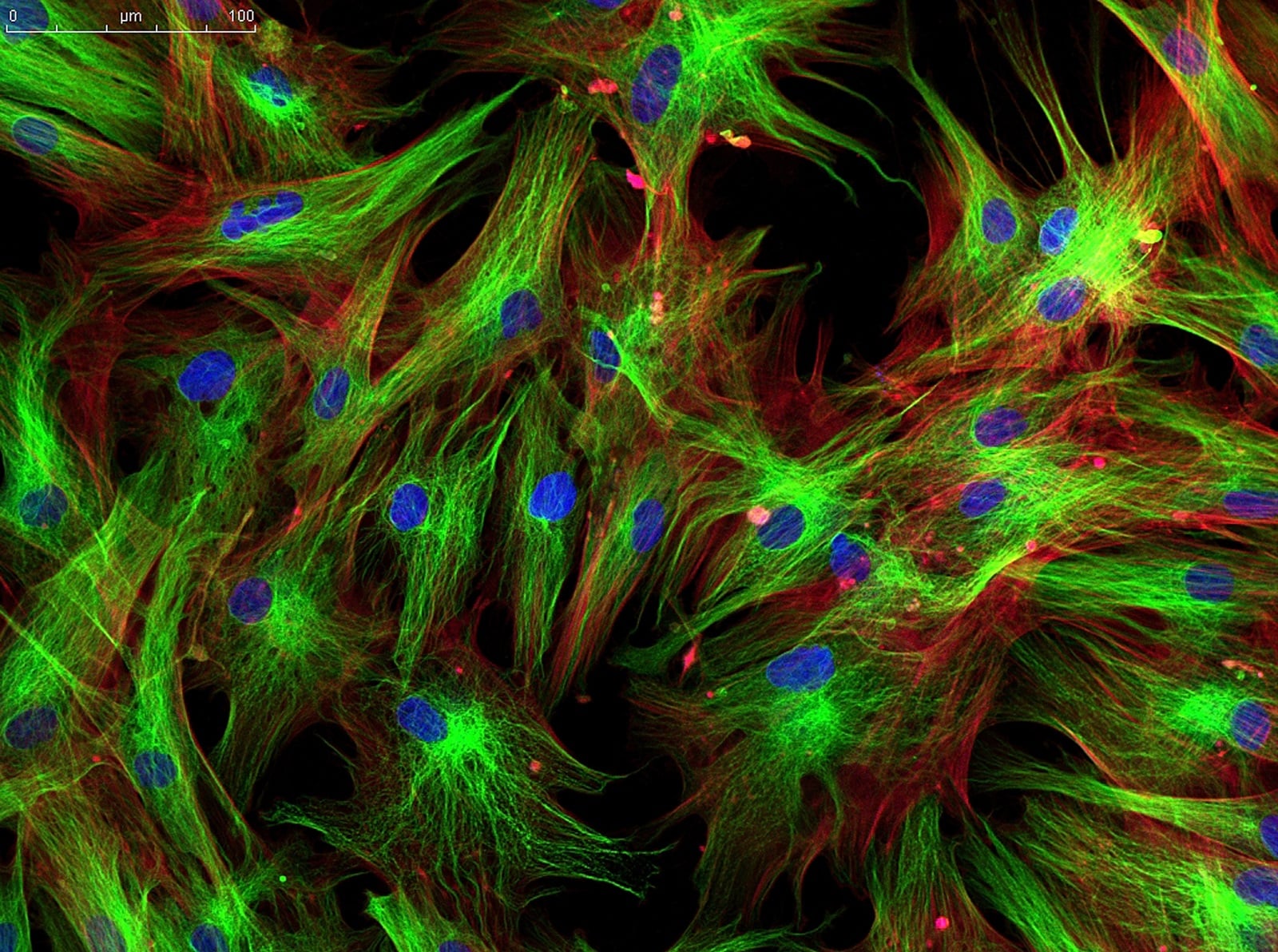 Immunofluorescence Validated Antibodies | Biocompare: The Buyer's Guide ...