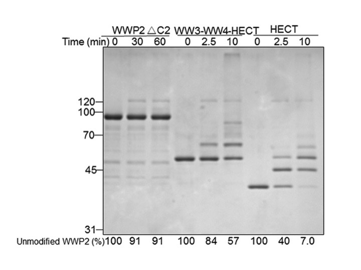 Colloidal Blue Staining Kit for High-Sensitivity Staining of Protein ...