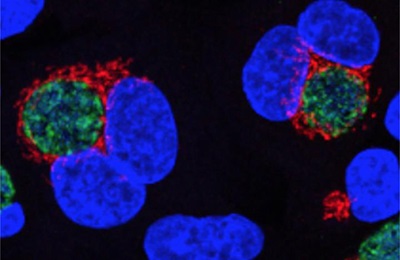 How Chlamydia Thrives Inside Its Host | Biocompare: The Buyer's Guide ...