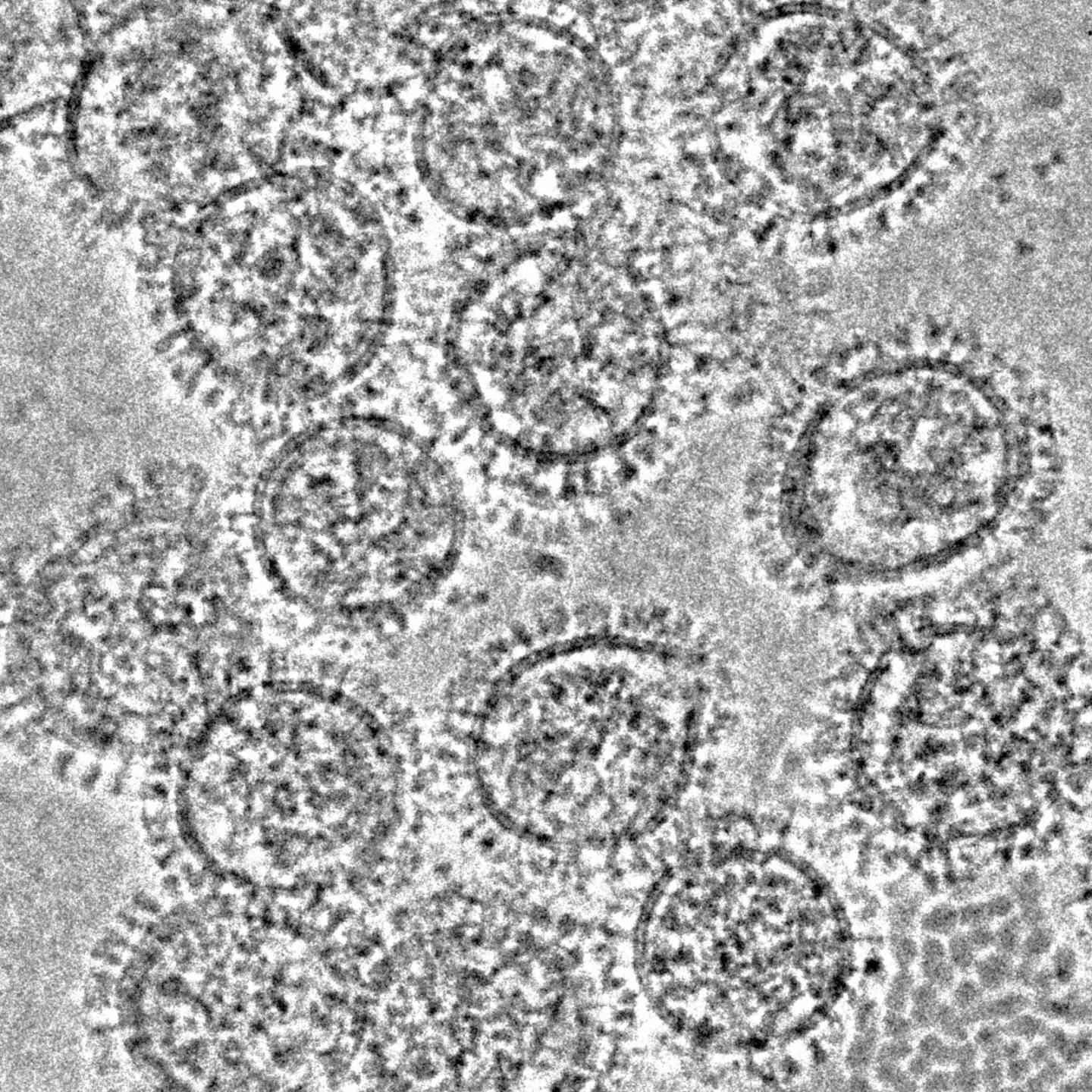 Candidate for Universal Flu Vaccines Blocks Two Key Viral Proteins ...