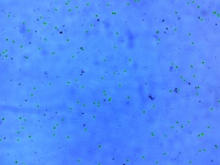 LUNA-II Makes Cell Counting a Breeze | Biocompare Product Review.