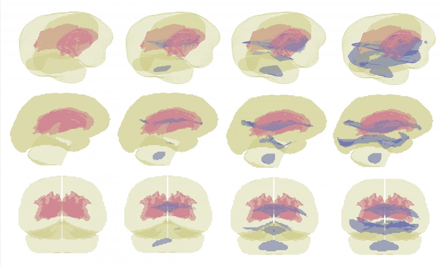 How Hits to the Head Impact the Brain | Biocompare: The Buyer's Guide ...