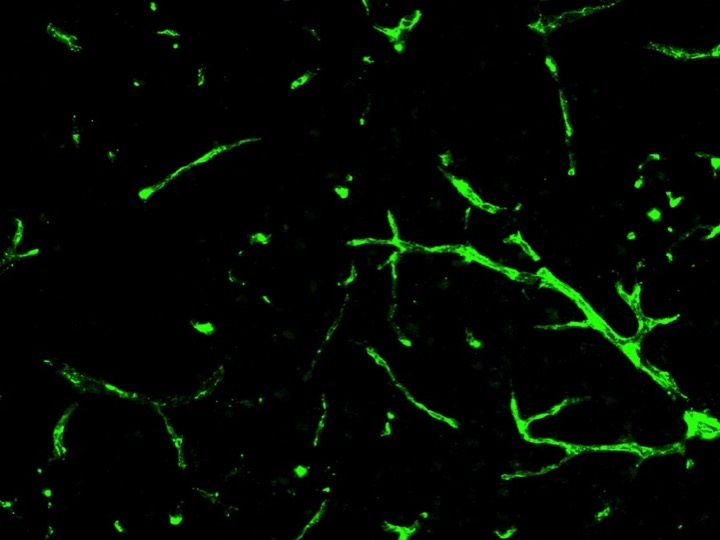 Good Antibody to Stain Collagen IV from Abcam | Biocompare Antibody Review