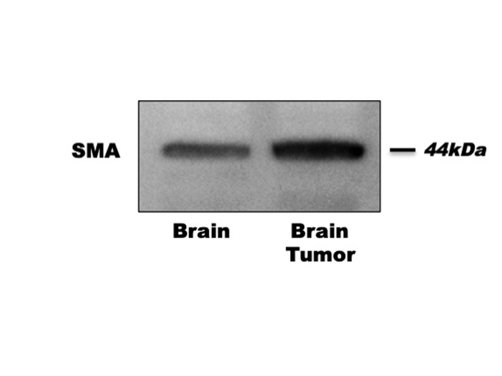 Detection of SMA Expression in Mouse Brain | Biocompare Antibody Review