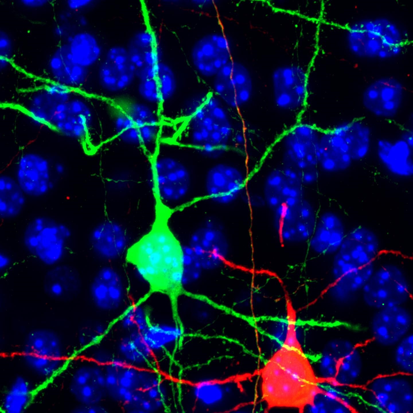 A Gene Paradox: Promoting and Inhibiting Growth | Biocompare: The Buyer ...