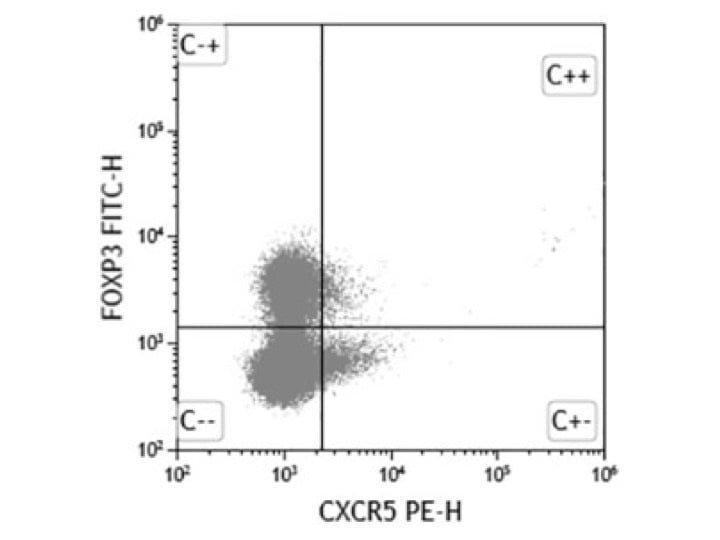 Excellent Antibody for Mouse CXCR5 Staining | Biocompare Antibody Review