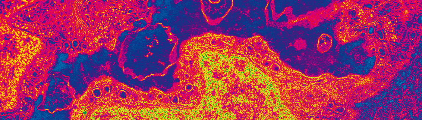 Correlative Microscopy Becoming More Accessible and Fruitful ...