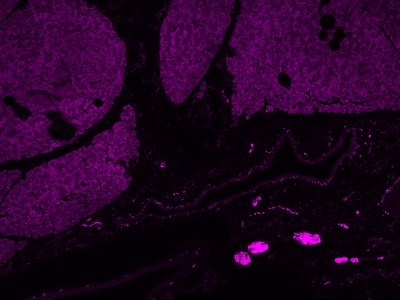 Unspecific Staining in Human Pancreas Tissue Section | Biocompare ...