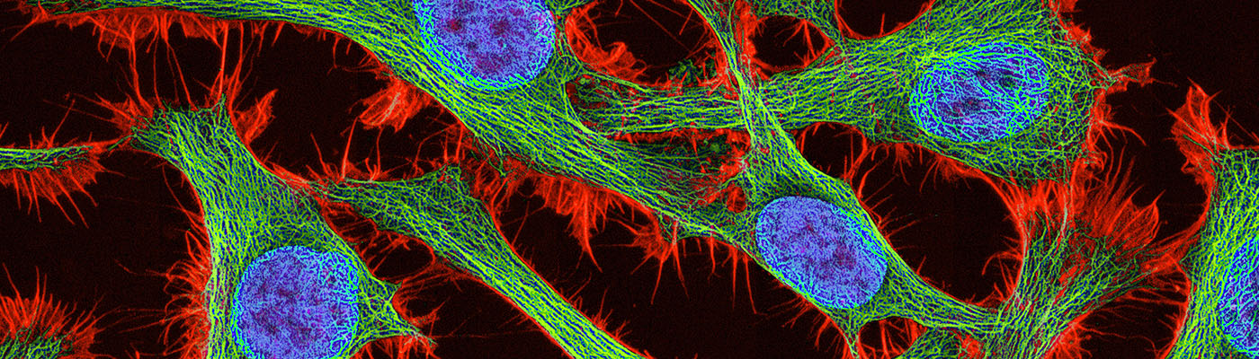 How To Prevent Cell Culture Contamination Biocompare The Buyer s 