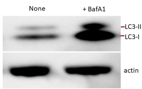 LC3B Antibody Works Well | Biocompare Antibody Review