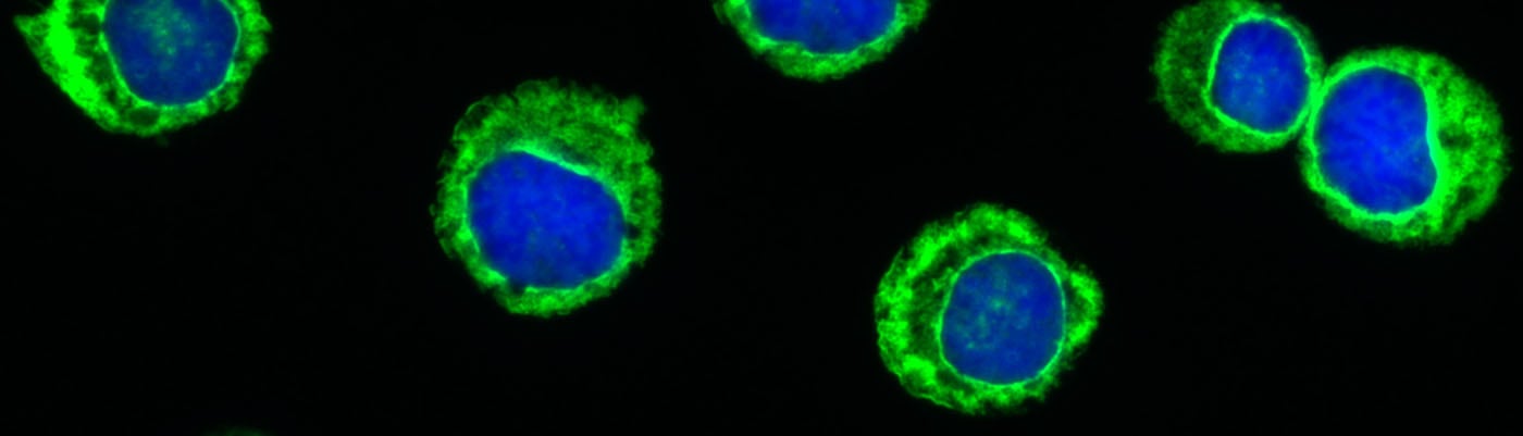 CRISPR-Engineered Immunotherapies Show Promise | Biocompare.com
