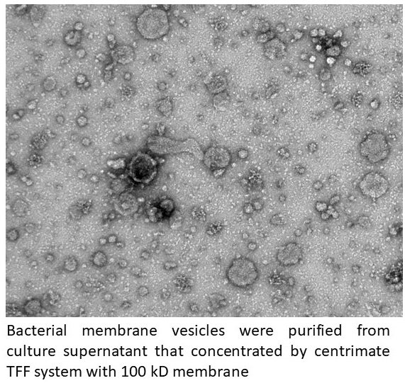 LV Centramate™ TFF System Works Great for Purification of EVs ...