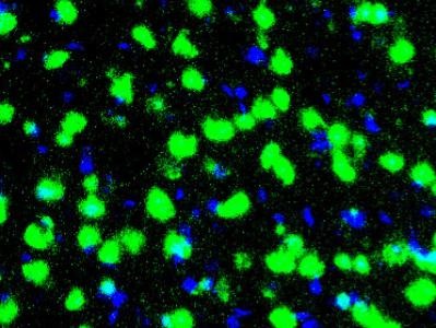 Cortical Neuron Staining via Anti-SATB1 + SATB2 Antibody | Biocompare ...