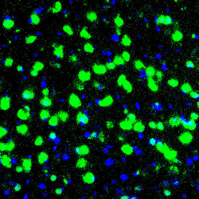 Cortical Neuron Staining via Anti-SATB1 + SATB2 Antibody | Biocompare ...