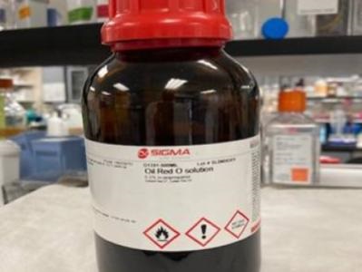 Nice Oil Red O solution | Biocompare.com Kit/Reagent Review