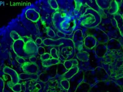 Excellent Marker to Visualize Basal Membrane in Tissues | Biocompare ...