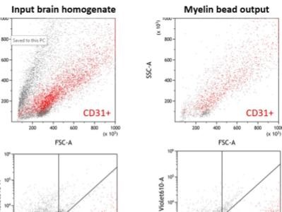 Good Kit for Myelinated Cell Removal | Biocompare.com Kit/Reagent Review