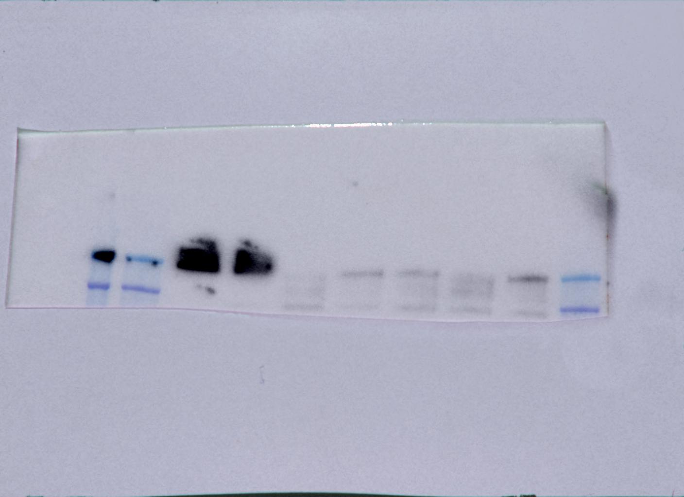 ZO-1 Antibody from Thermo Fisher Works Well | Biocompare Antibody Review