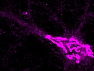 GM130 as a Golgi Marker for Immunofluorescence in Cultured Hippocampal ...