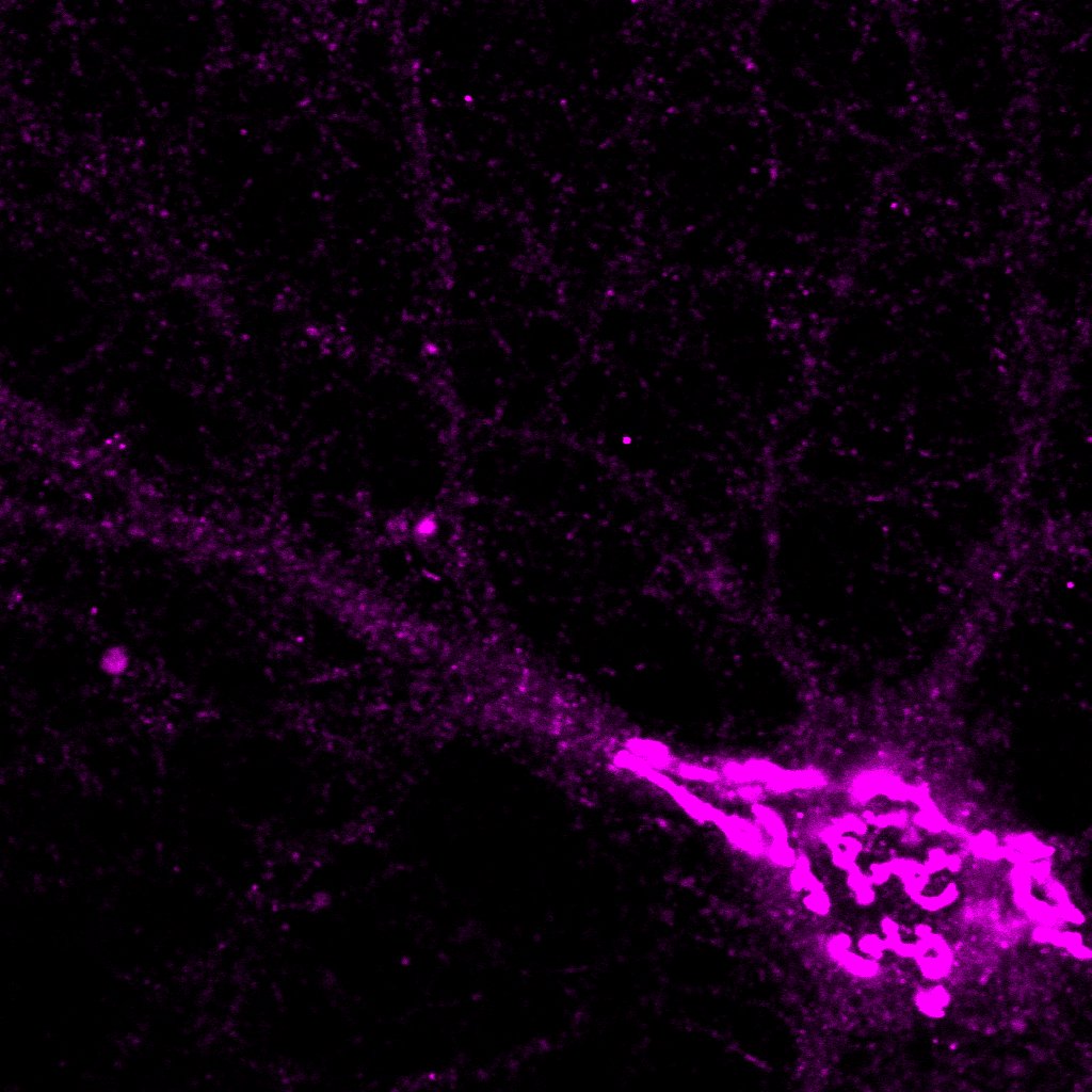 GM130 as a Golgi Marker for Immunofluorescence in Cultured Hippocampal ...