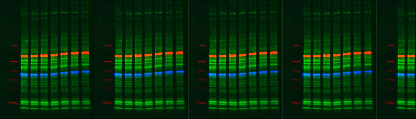 Western Blot Image Analysis | Biocompare: The Buyer's Guide for Life ...