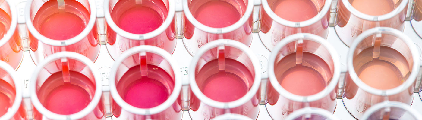 Selecting the Right Cell-Based Assay | Biocompare: The Buyer's Guide ...