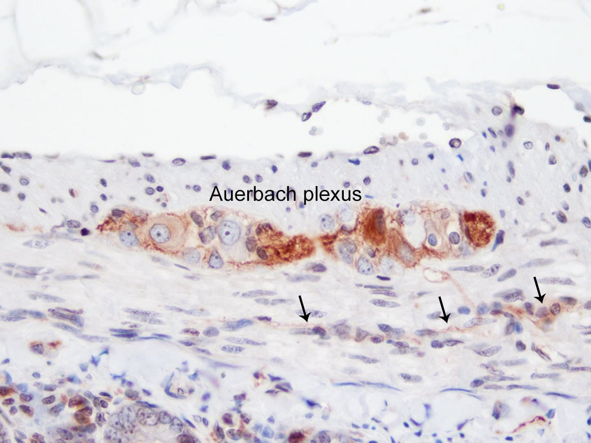 Specific Staining with Neurofilament 200 Antibody | Biocompare Antibody ...