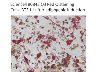 Easy to Use Oil Red O Kit From ScienCell | Biocompare.com Kit/Reagent ...