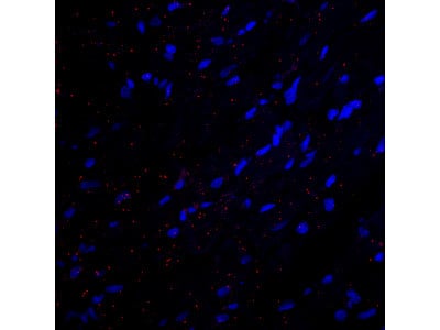 Cdkn2a Probe From ACD for the Accurate Detection of mRNA Levels ...