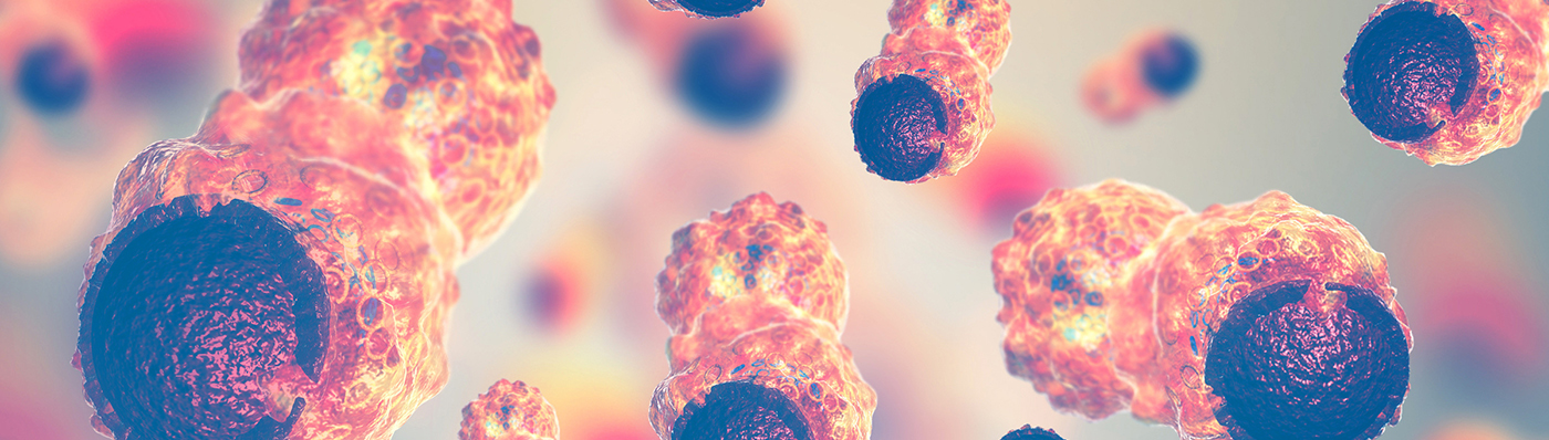 Detecting Cancer Relapse: The Future of MRD Technologies | Biocompare ...