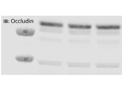 Occludin Detected by Western Blot in Human Cerebral Microvascular ...
