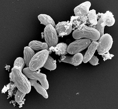 CHO Cells: Beginning of the End or End of the Beginning? | Biocompare ...