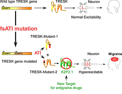 How Hyperexcitability in Sensory Neurons Leads to Migraines ...