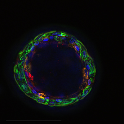 Improving Drug Discovery with Organoids | Biocompare: The Buyer's Guide ...