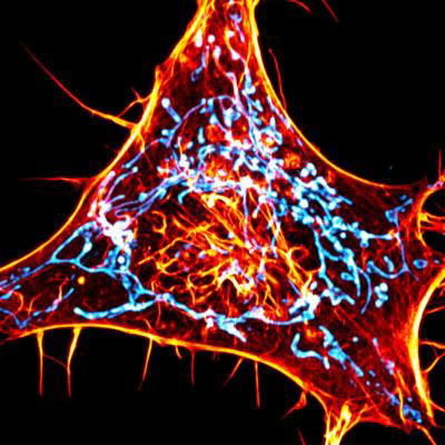 Actin and Mitochondria Interactions Revealed with New Imaging Method ...