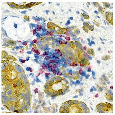 Tips for Successful IHC Staining | Biocompare: The Buyer's Guide for ...