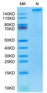 Human HLA-A*02:01&B2M&AFP (FMNKFIYEI) Tetramer Protein (MHC-HM407T) from Kactusbio Inc ...